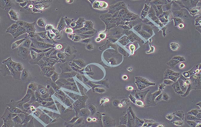 PLC/PRF/5人肝癌亚力山大细胞(STR鉴定）价格,详情介绍-960化工网 – 960化工网