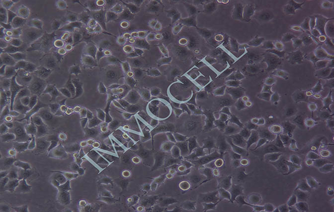 PANC-1人胰腺癌细胞 价格丨panc-1细胞丨逸漠(immocell)价格,详情介绍-960化工网 – 960化工网