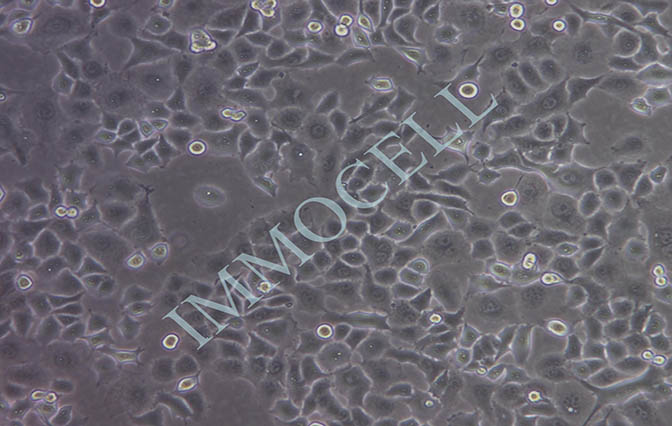PANC-1人胰腺癌细胞 价格丨panc-1细胞丨逸漠(immocell)价格,详情介绍-960化工网 – 960化工网
