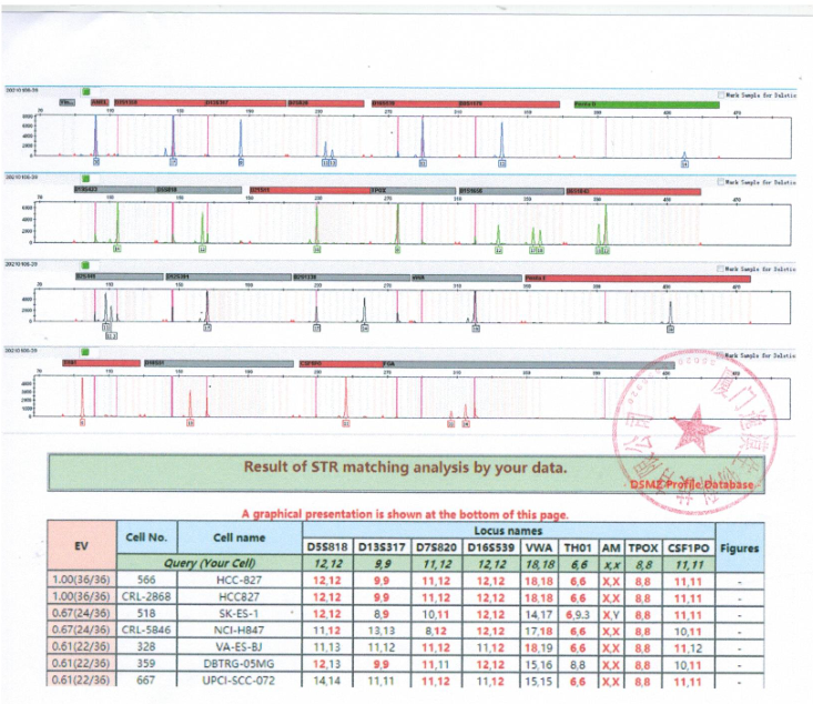 HCC827人非小细胞肺癌细胞(STR鉴定)丨hcc827细胞价格,详情介绍-960化工网 – 960化工网