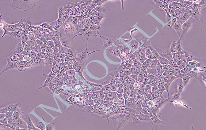 HCC827人非小细胞肺癌细胞(STR鉴定)丨hcc827细胞价格,详情介绍-960化工网 – 960化工网