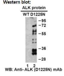 Anti-ALK (D1225N) Mouse Monoclonal Antibody点突变抗体价格,详情介绍-960化工网 – 960化工网