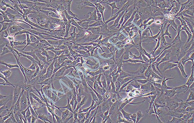 WPMY-1人正常前列腺基质永生化细胞丨wpmy-1细胞(STR鉴定)价格,详情介绍-960化工网 – 960化工网