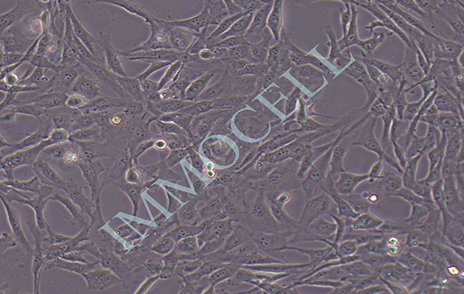 WPMY-1人正常前列腺基质永生化细胞丨wpmy-1细胞(STR鉴定)价格,详情介绍-960化工网 – 960化工网