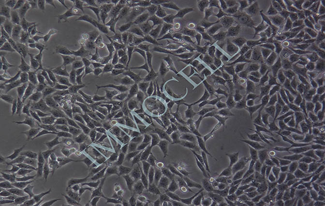 HGC-27人胃癌细胞（未分化）丨HGC-27细胞株(STR鉴定)价格,详情介绍-960化工网 – 960化工网