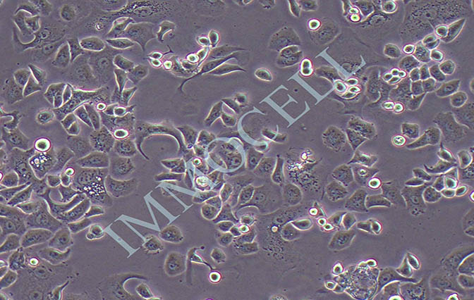 SK-BR-3人乳腺腺癌细胞丨sk-br-3 细胞株丨[SK-BR-3]细胞价格,详情介绍-960化工网 – 960化工网