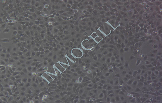 5637人膀胱癌细胞丨5637细胞(STR鉴定)丨[5637]细胞株价格,详情介绍-960化工网 – 960化工网