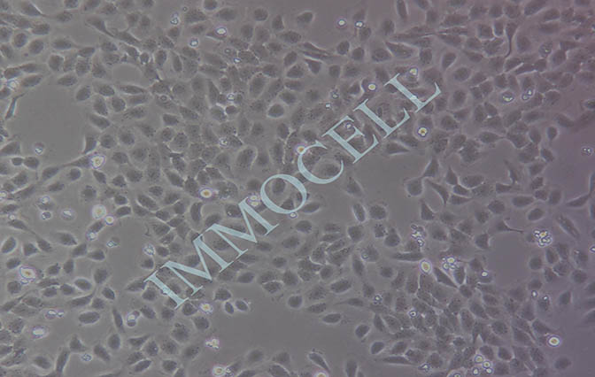 5637人膀胱癌细胞丨5637细胞(STR鉴定)丨[5637]细胞株价格,详情介绍-960化工网 – 960化工网