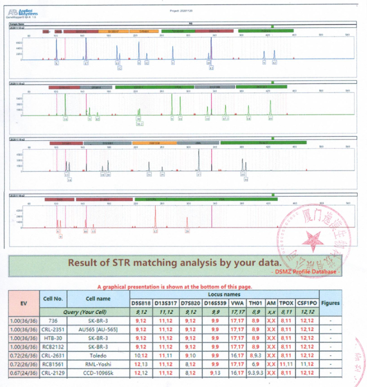 SK-BR-3人乳腺腺癌细胞丨sk-br-3 细胞株丨[SK-BR-3]细胞价格,详情介绍-960化工网 – 960化工网