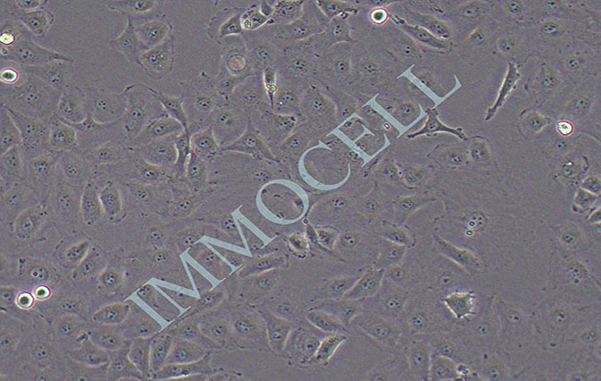 ECV-304 人膀胱癌细胞(STR鉴定)价格,详情介绍-960化工网 – 960化工网