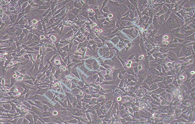 TM4正常小鼠睾丸Sertoli细胞丨tm4细胞丨TM4价格,详情介绍-960化工网 – 960化工网