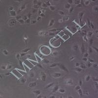 CD8+T人淋巴细胞丨CD8+T细胞丨逸漠(immocell)价格_品牌:IMMOCELL-丁香通