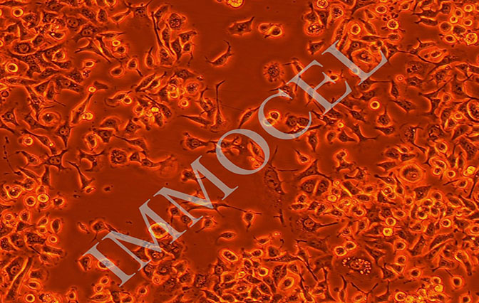 E0771小鼠乳腺癌细胞丨e0771细胞价格,详情介绍-960化工网 – 960化工网