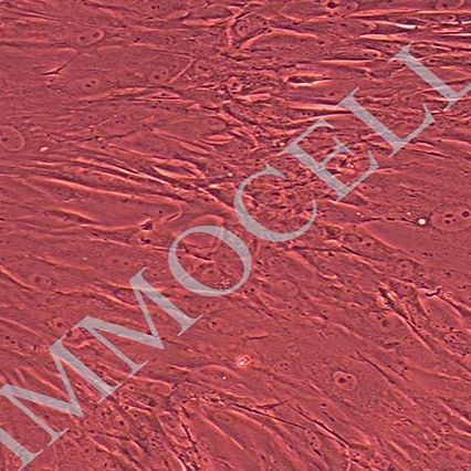 HFF-1人包皮成纤维细胞丨HFF-1细胞株丨逸漠(immocell)价格_品牌:IMMOCELL-丁香通官网