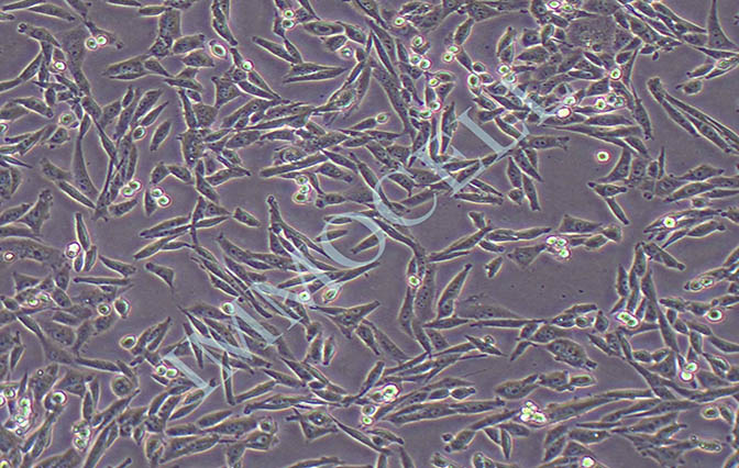 HELF人胚肺成纤维细胞丨HELF细胞株价格,详情介绍-960化工网 – 960化工网