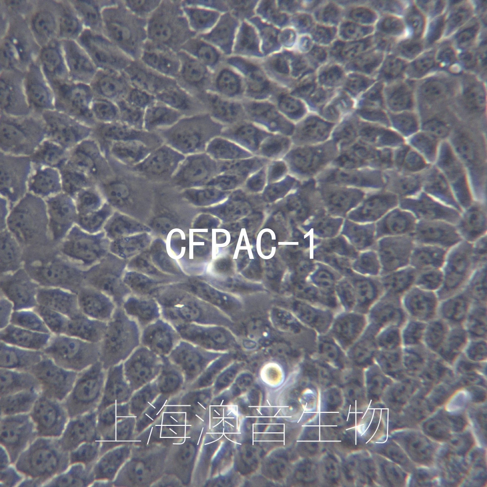 CFPAC-1[ CFPac-1; CF PAC-1; CF-PAC1; CF-Pac1; CF Pac1; CFPAC1; CFPAC]胰腺 ...