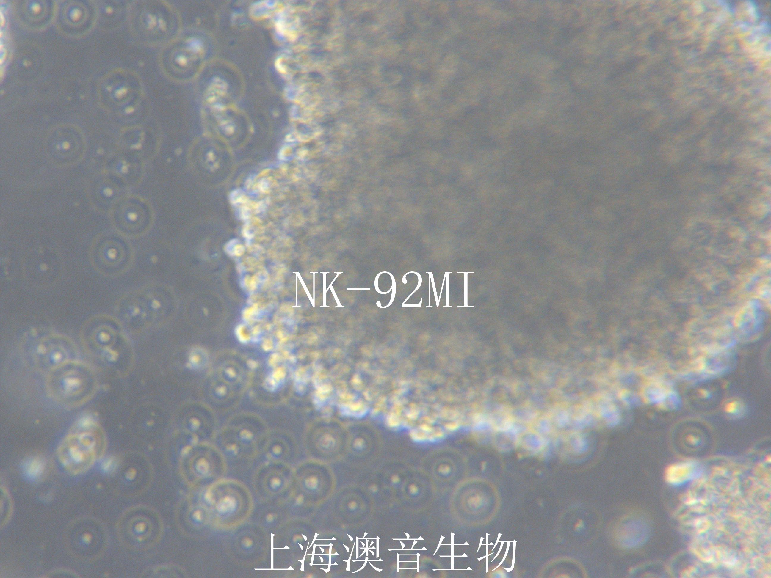 NK-92MI [NK92MI]恶性非霍奇金淋巴瘤患者的自然杀伤细胞价格,详情介绍-960化工网 – 960化工网