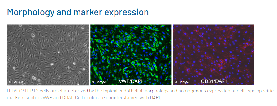 Evercyte GmbH公司 Kidney PODO/SVTERT152 永生化足细胞 - 北京孚博生物科技有限公司