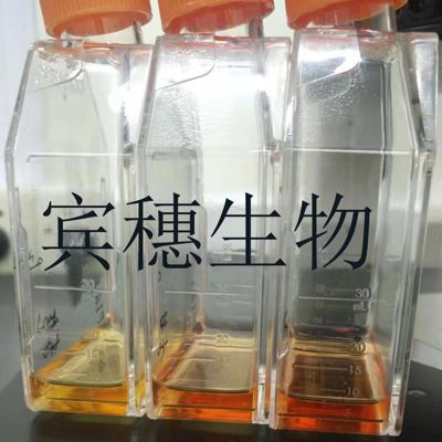 HBEC-5i Cell;HBEC-5i传代培养(STR标准图谱)价格_品牌:宾穗生物-丁香通官网