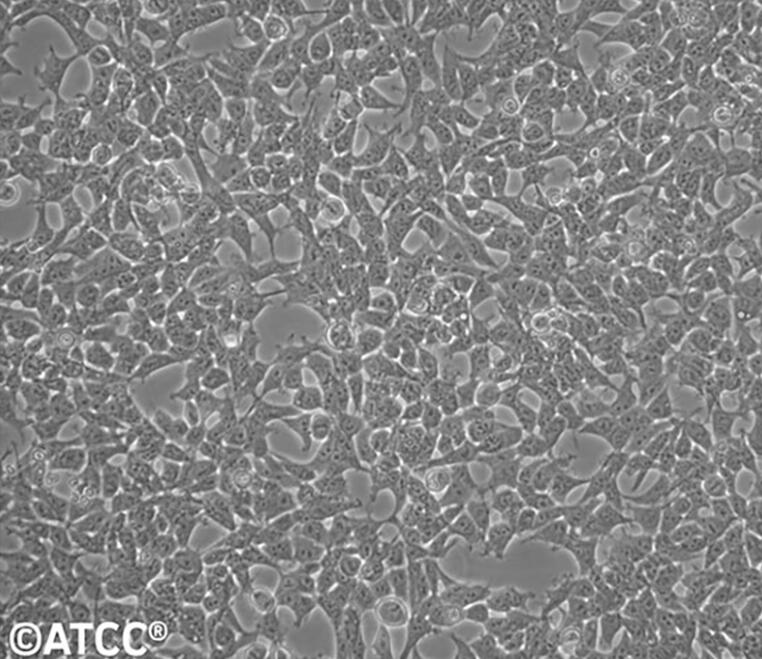 293T细胞怎样才能养得好？_公司新闻_丁香通