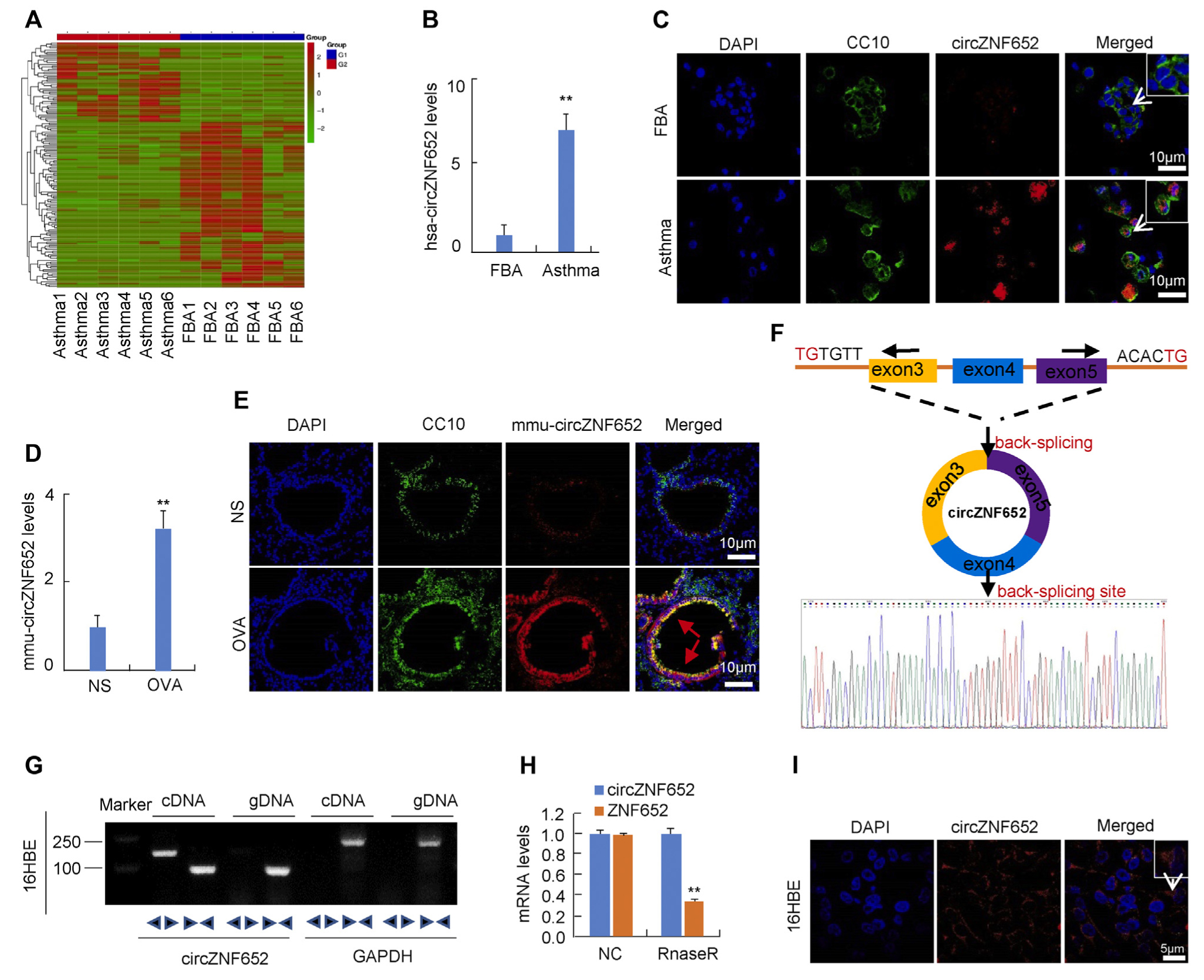 IF10+客户文章揭示了circZNF652在调节过敏性气道上皮重塑中的潜在作用机制-公司新闻-广州市锐博生物科技有限公司