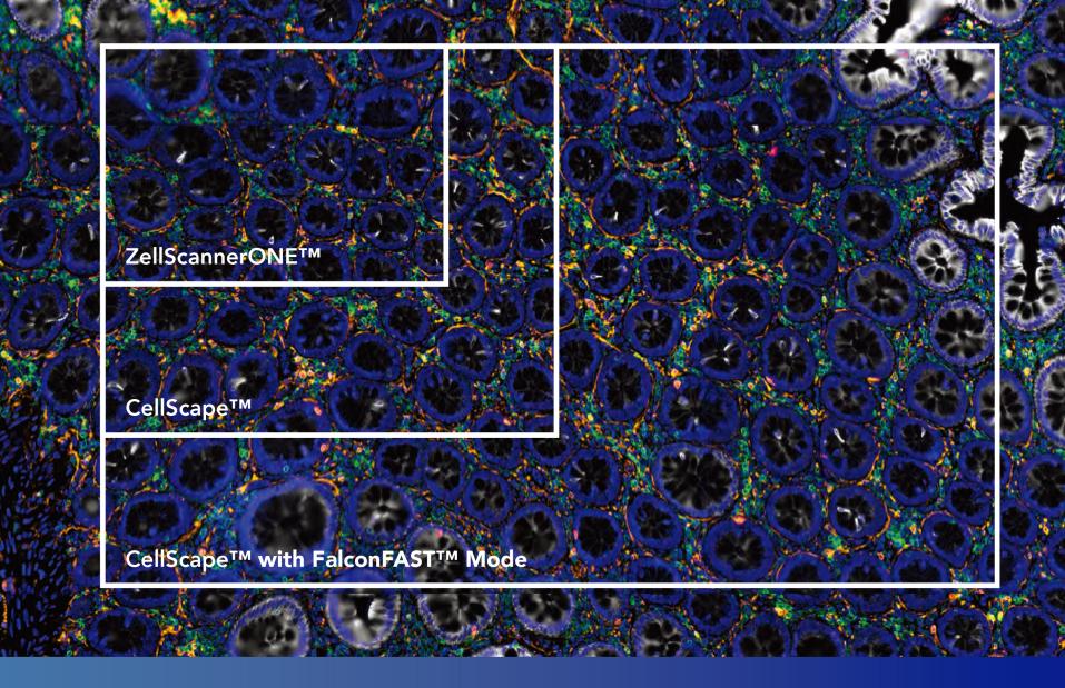 【新品发布】Canopy公司推出新一代微环境多靶标蛋白分析系统CellScape™， 与上代产品相比，相同时间内可获得两倍的数据量，且图像 ...