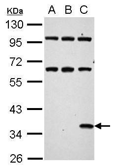 Renilla Luciferase antibody价格_品牌:GeneTex-丁香通官网