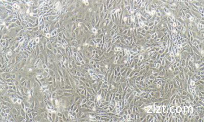 智立中特生物HBL-1人弥漫性大B细胞淋巴瘤细胞简介 - 企业动态 - 丁香通