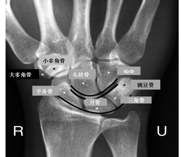手腕外伤急诊处理