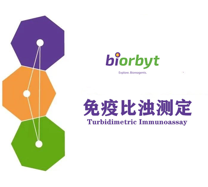 免疫比浊测定Turbidimetric Immunoassay - 企业动态 - 丁香通