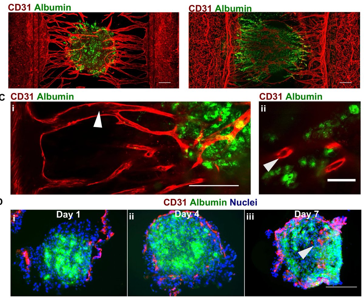 科技突破 MIMETAS实现血管化肝脏类器官芯片-器官芯片OrganoPlate Graft® 平台 - 企业动态 - 丁香通