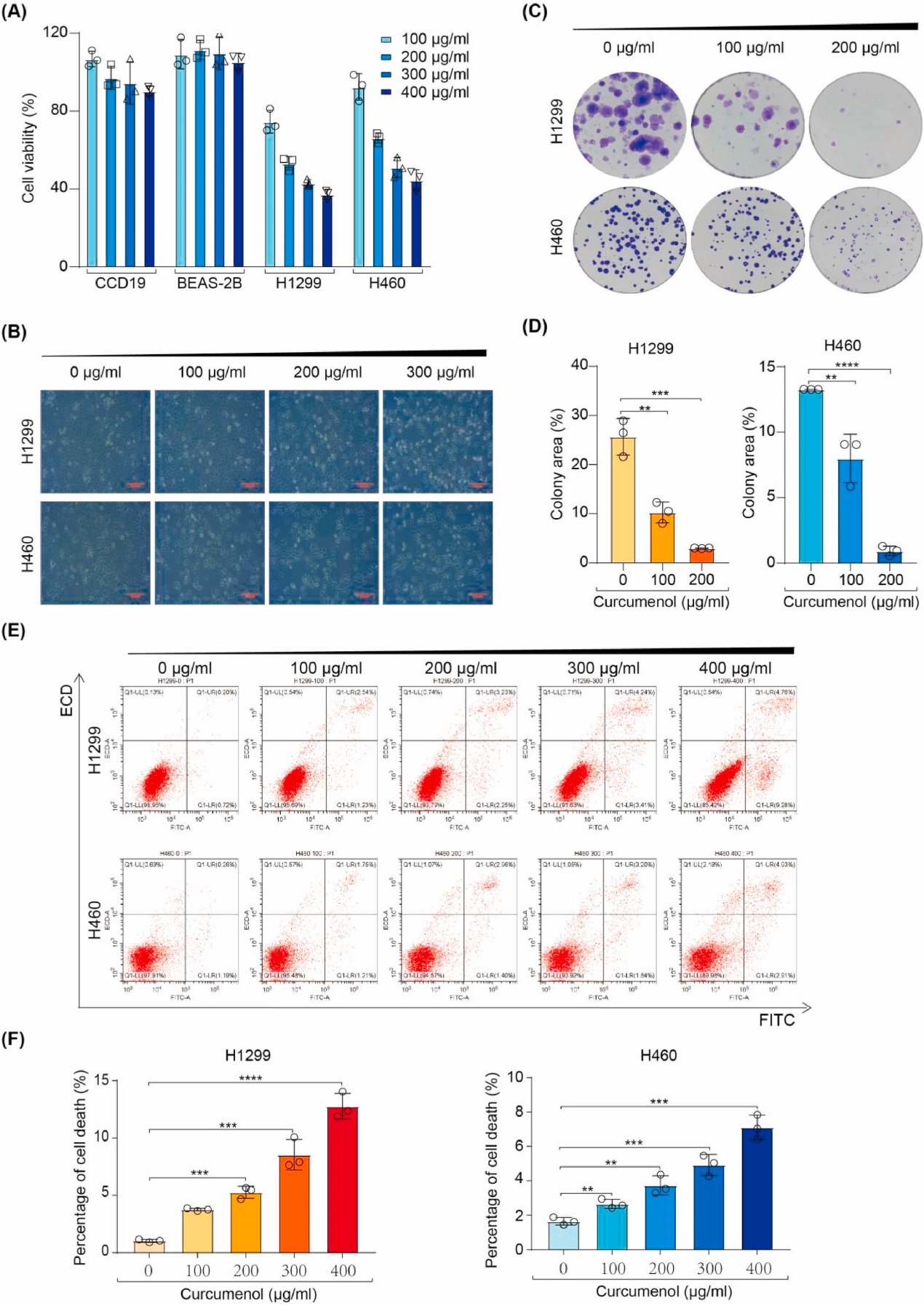 姜黄烯醇通过lncRNA H19/miR-19b-3p/FTH1轴触发肺癌细胞铁死亡 - 企业动态 - 丁香通
