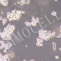 CD8+T人淋巴细胞丨CD8+T细胞丨逸漠(immocell)价格_品牌:IMMOCELL-丁香通
