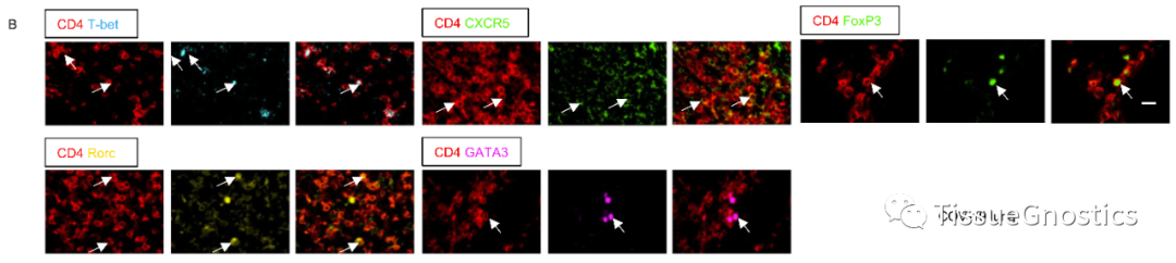TissueFAXS Cytometry技术再助力MIT团队在新冠肺炎T细胞亚群研究的新发现-公司新闻-TissueGnostics Asia Pacific Limited（TG亚太）