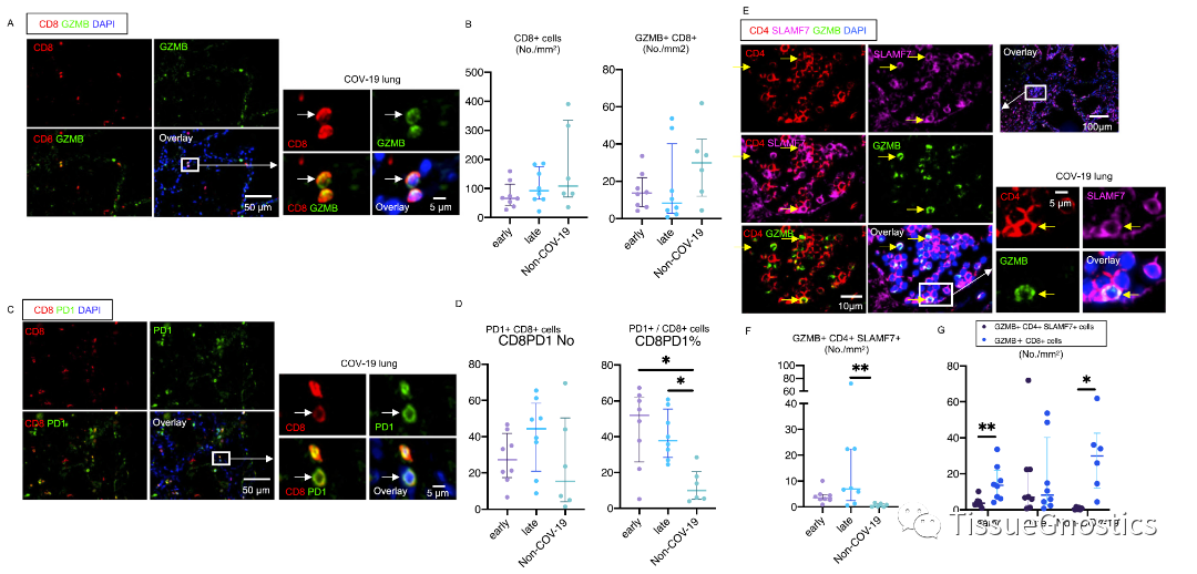 TissueFAXS Cytometry技术再助力MIT团队在新冠肺炎T细胞亚群研究的新发现-公司新闻-TissueGnostics Asia Pacific Limited（TG亚太）