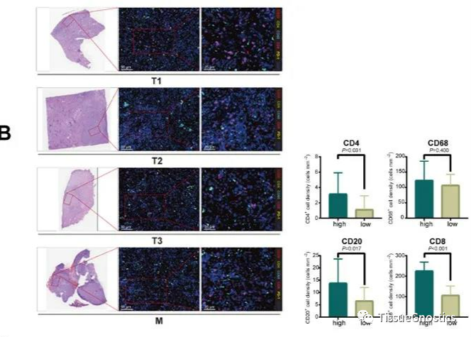 CAR-T实体瘤治疗挑战重重，TissueFAXS Cytometry技术如何助力？ - 企业动态 - 丁香通