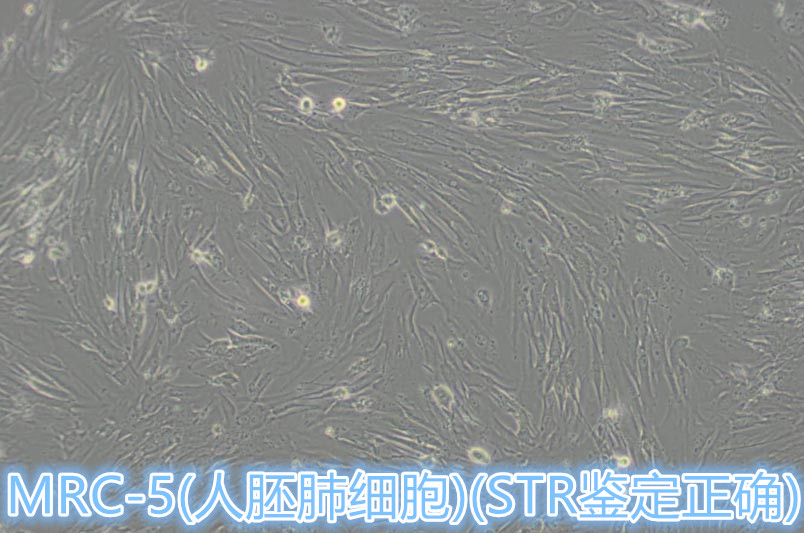 MRC-5细胞(人胚肺细胞) (STR鉴定正确)价格_品牌:Procell-丁香通官网