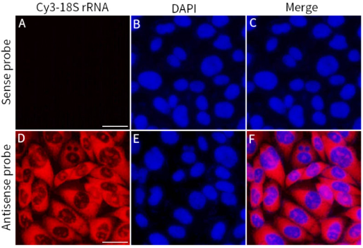 囤货节好物|荧光原位杂交(FISH)产品重磅上线! - 企业动态 - 丁香通