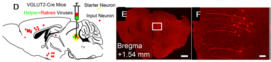 【客户文章】空军军医大学李云庆教授、董玉琳副教授团队在dmPFC-vlPAG投射神经元参与疼痛维持阈值和抗焦虑行为研究取得新进展_公司新闻_丁香通