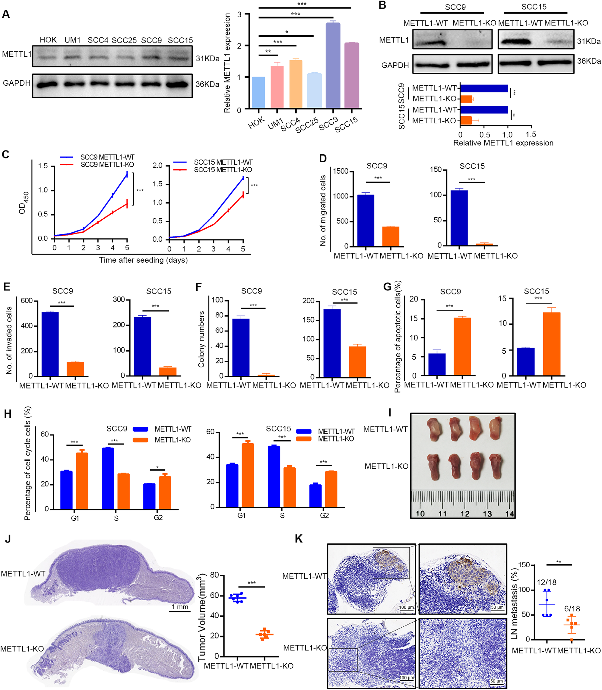 国自然热点之m7G:METTL1/WDR4介导的tRNA m7G修饰调控mRNA翻译驱动头颈部鳞癌-公司新闻-上海英拜生物科技有限公司