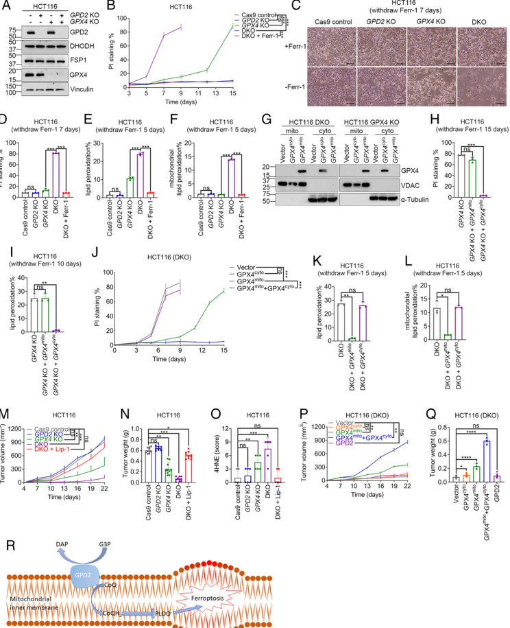 线粒体和铁死亡——GPD2协同线粒体GPX4抵御铁死亡 - 上海英拜生物科技有限公司 - 最新研究动态 - 丁香通