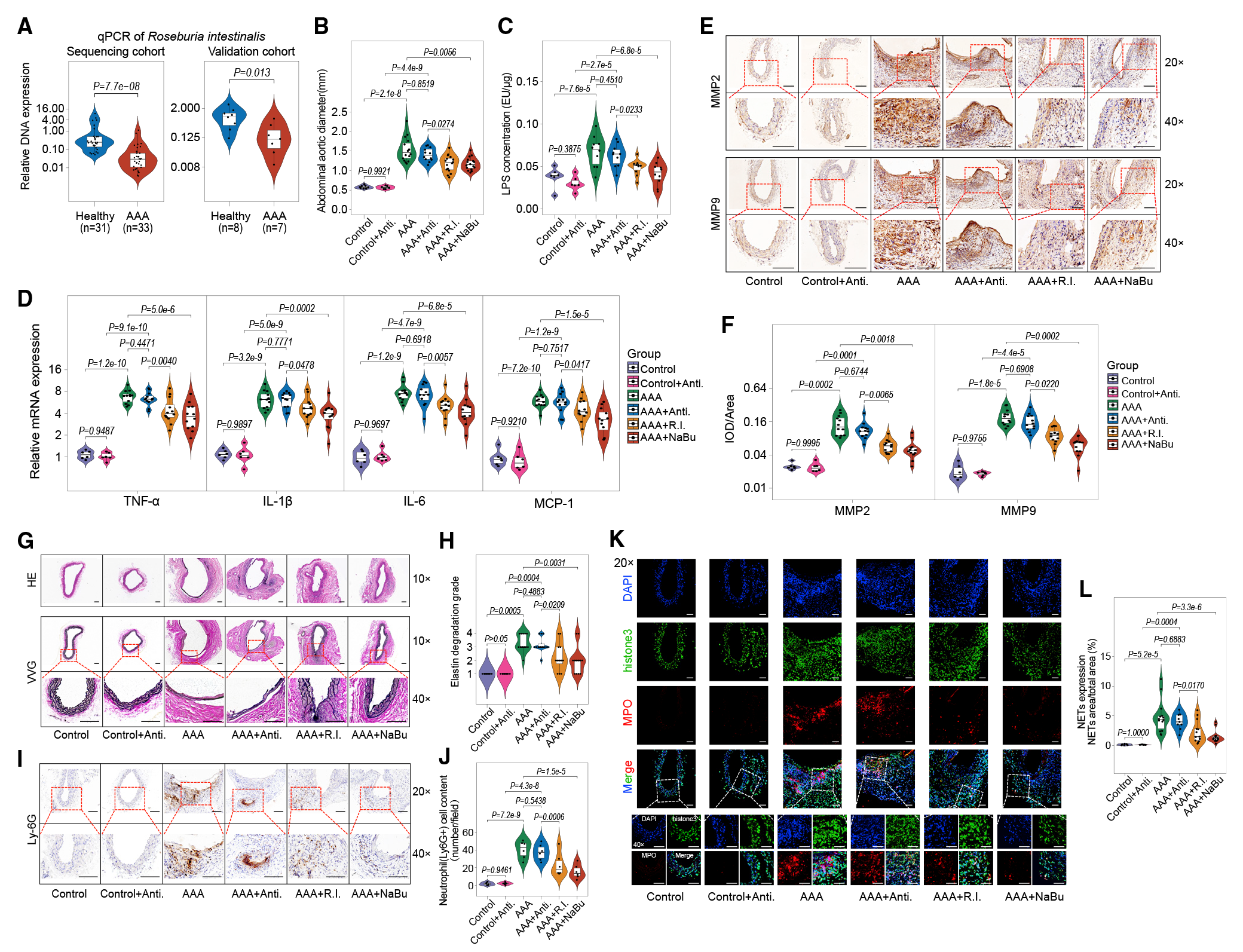 项目文章Cell Host Microbe（IF 31）| 齐鲁医院&山东省立医院利用多组学揭示肠道微生物群失调加重腹主动脉瘤-公司新闻-上海中科新生命生物科技有限公司