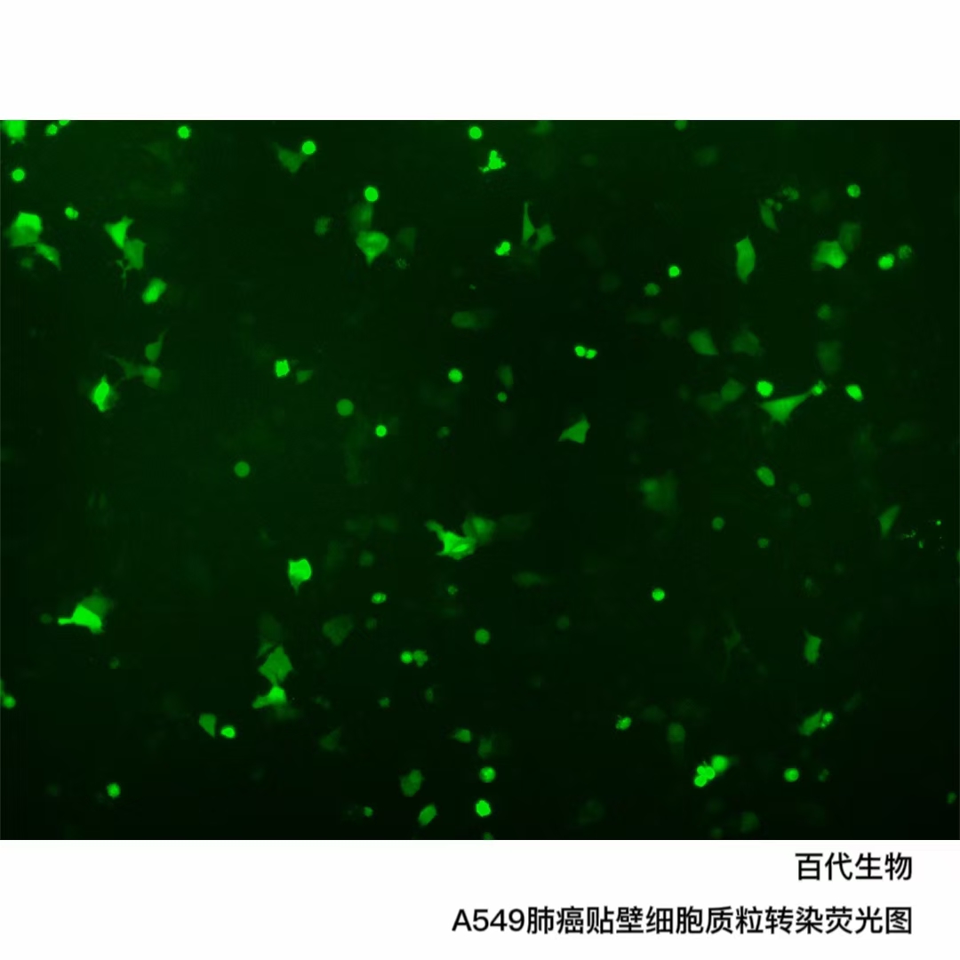 如何选择A549肺癌细胞质粒转染试剂 - 企业动态 - 丁香通