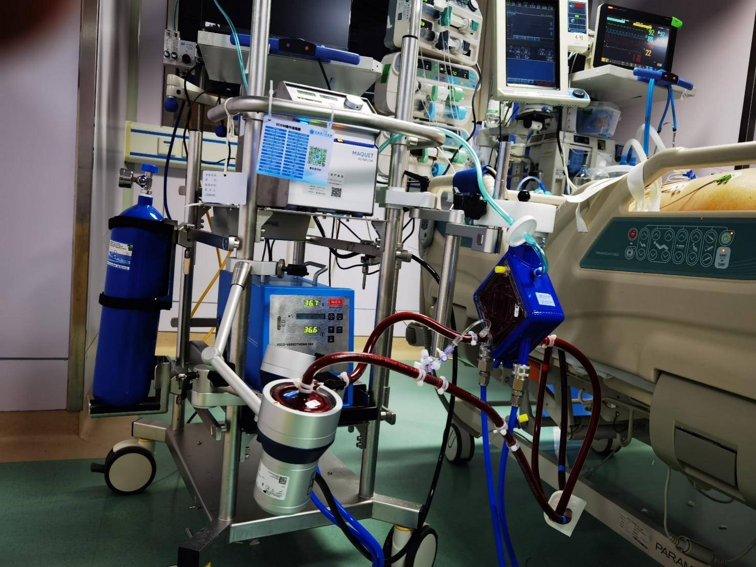 ECMO 治疗救重症 区域医疗中心建设显成效 - 医院汇 - 丁香园