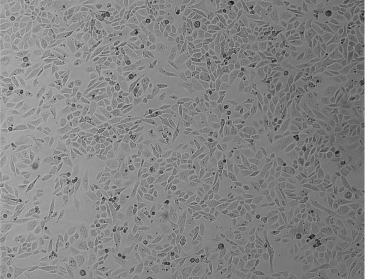 干货！！SK-LU-1（人低分化肺腺癌细胞）传代标准操作流程 - 企业动态 - 丁香通