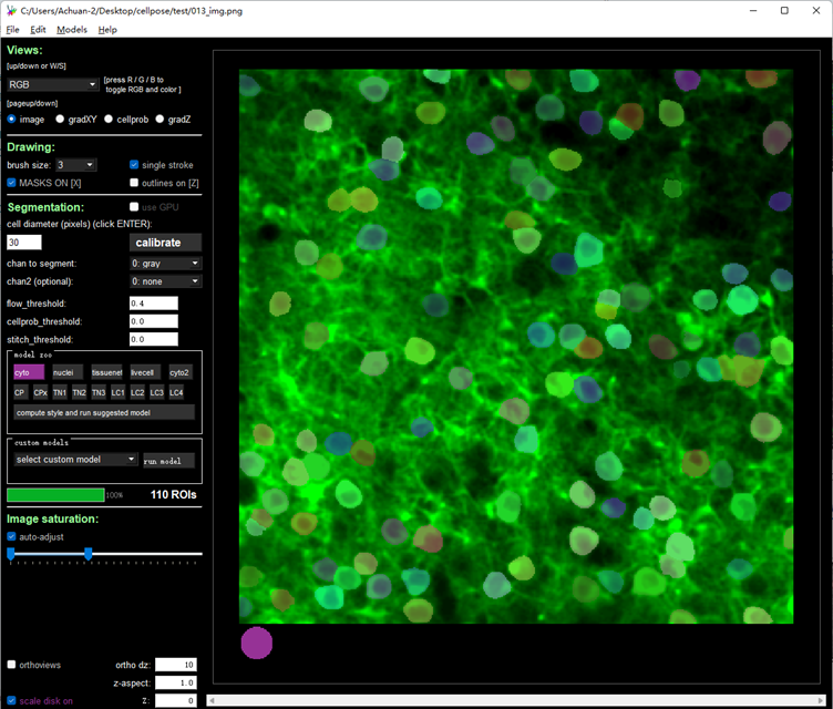 科技前沿 | "AI的狂飙" Cellpose: 细胞分割领域的ChatGPT-公司新闻-仪景通光学科技（上海）有限公司