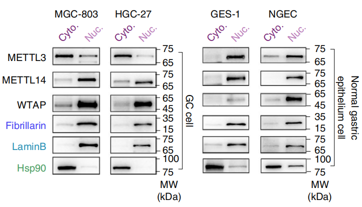 NCB(IF=28) |胃癌新机制：METTL3优先增强表观遗传因子的非m6A翻译并促进肿瘤发生-公司新闻-广州卿泽生物科技有限公司