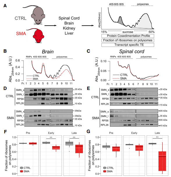 Polysome profiling在复杂疾病中的应用研究 - 企业动态 - 丁香通