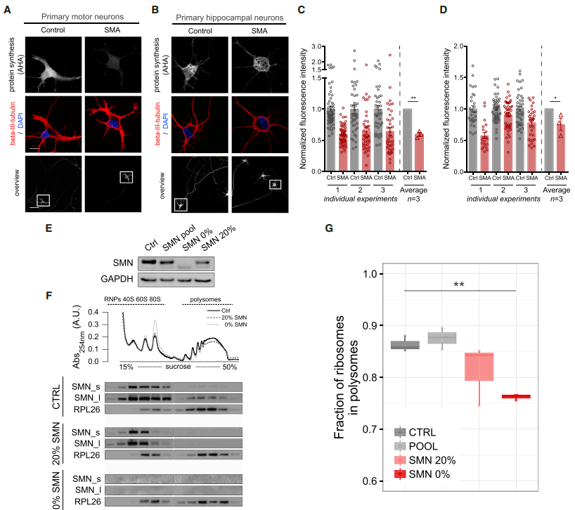 Polysome profiling在复杂疾病中的应用研究 - 企业动态 - 丁香通