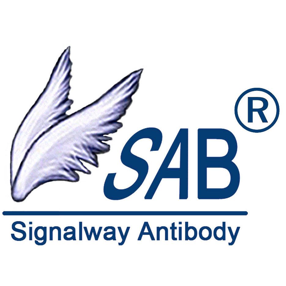 xCT Rabbit mAb价格_品牌:Signalway Antibody-丁香通